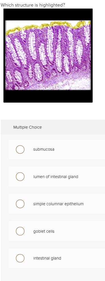 Solved 51 Which Structure Is Highlighted Multiple Choice Submucosa Lumen Of Intestinal Gland
