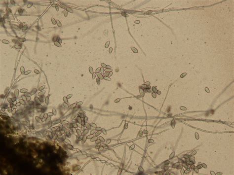 Phytophthora Infestans Microscope