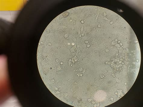 What Type Of Cell Contamination Is This ResearchGate