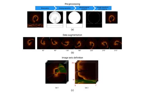 Images Illustrating The Pre Processing Steps A Pre Processing Steps Download Scientific