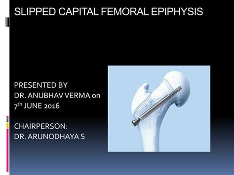 Scfe Pptx Hormonal Disorders Endocrine And Metabolic Diseases