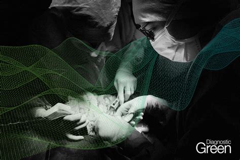 The Added Value Of Intraoperative Near Infrared Fluorescence Imaging In Elective Laparoscopic