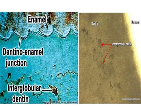Dentin Development Pptx Bone And Joint Conditions Diseases And Conditions