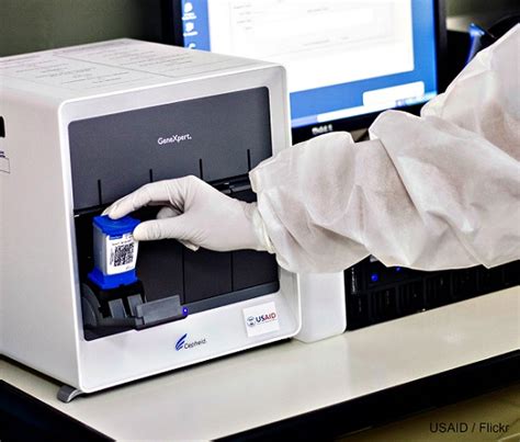 Genexpert Noble Diagnostics Genexpert Noble Diagnostics