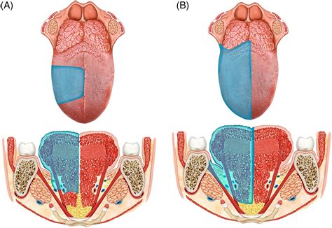 Dissection Human Tongue
