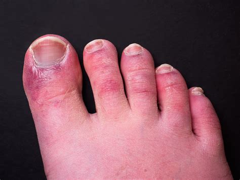 The Royal College Of Podiatry
