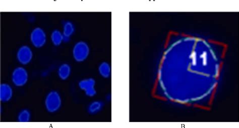 Figure 1 From Cervical Cancer Classification From Pap Smears Using An Enhanced Fuzzy C Means