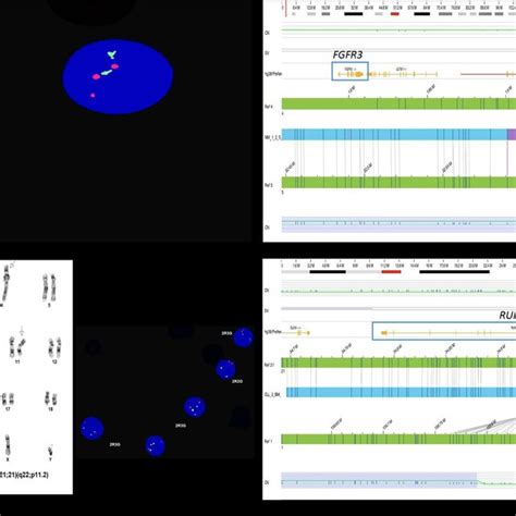 Optical Genome Mapping Corrected False Positive Results In Two Cases Download Scientific