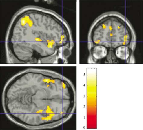 Figure 2 From Role Of The Orbitofrontal Cortex In Reinforcement Processing And Inhibitory