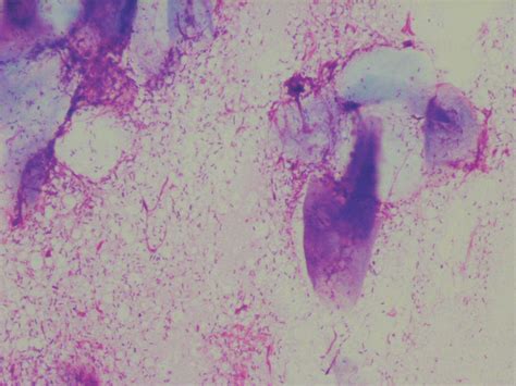 Superficial Pyoderma In Dogs Clinical Overview And Diagnosis
