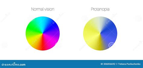 Protanomaly And Protanopia Stock Vector Illustration Of Diagram 306856692