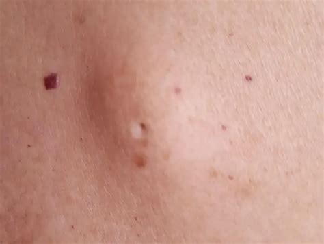 Ниацин витамин В3 никотинова киселина Arsmedica Bg