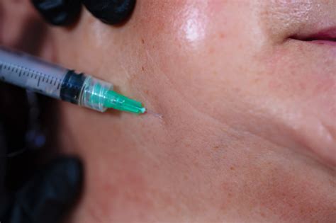 심미적 인 관리 및 피부 관리 젊은 피부를위한 백신 피부 회춘 절차 미적 클리닉에서 치료를받는 성숙한 여성 건강과 아름다움 개념 보톨리눔 독소 주사에 대한 스톡 사진 및