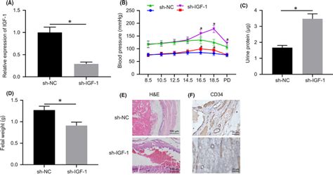 Silencing Of Igf‐1 Induces Pe Pathogenesis A The Expression Of Igf‐1