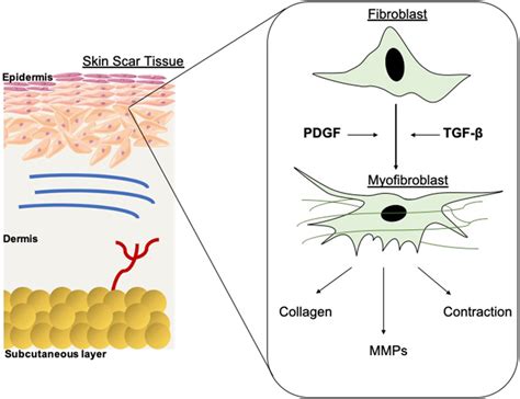Schematic Of Fibroblast Differentiation Into Myofibroblasts Within Scar Download Scientific