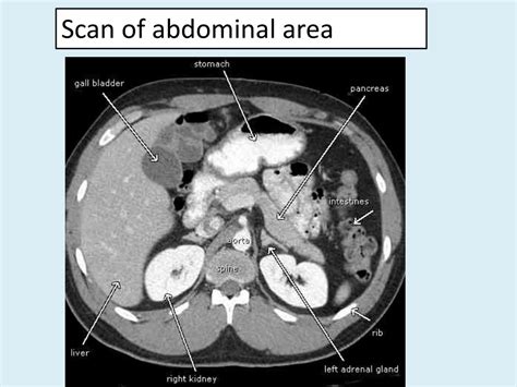 Ppt Name The Shape Of The Base Of The Following Prisms Rectangular