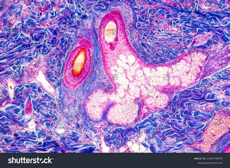 Scalp Hair Follicles Human Under Microscope Stock Photo Shutterstock