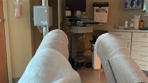 Frostbite Amputation