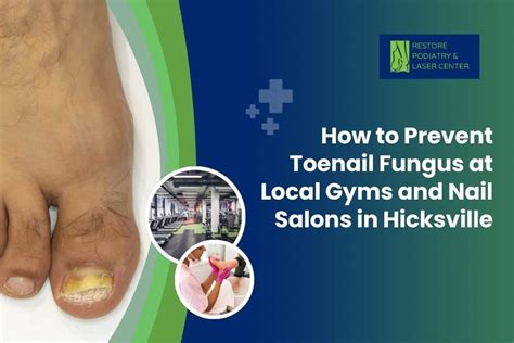 10 Tips To Prevent Toenail Fungus In Long Island Ny
