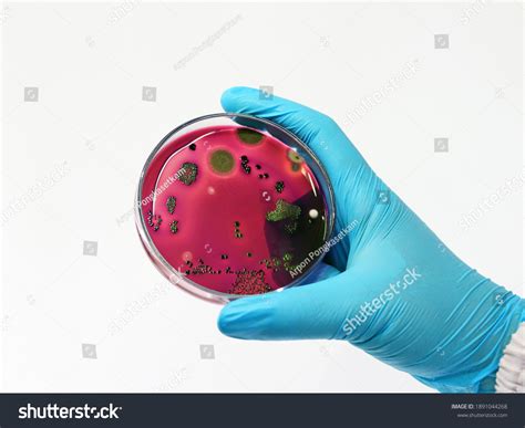 31 E Coli On Emb Agar 이미지 스톡 사진 및 벡터 Shutterstock