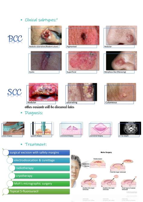 Difference Between Bcc And Scc Pdf