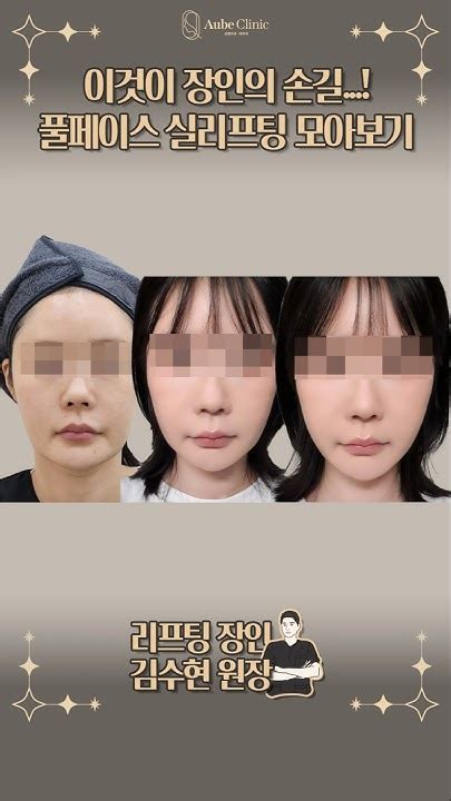 실리프팅 받고나면 어떻게 변할까⁉️ 실리프팅효과 실리프팅잘하는곳 필러 김수현원장 Shorts Youtube