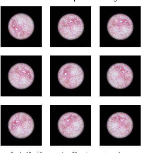 Figure 1 From Skin Lesion Classification Using Transfer Learning