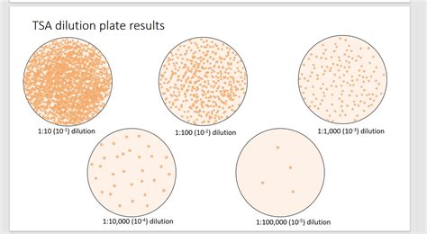 Solved Quantitative Urine Culture And Identification Of Chegg Com