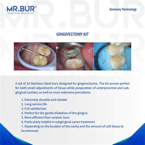 1 Best Gingivectomy Bur Kit Mr Bur Mr Bur