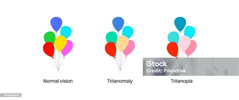 Tritanopia And Tritanomaly Stock Illustration Download Image Now Artists Palette Balloon