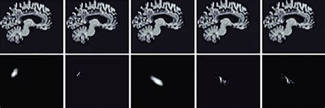 The Hippocampus Segmentation Result A Fcn Segmentation B Unet Download Scientific Diagram