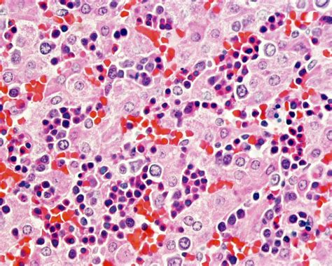 Liver Histology Structure Cells And Characteristics K