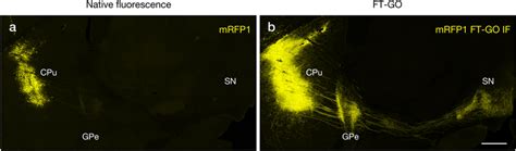 Neuroanatomical Tract Tracing Combined An Anterograde Aav Tracer With Download Scientific