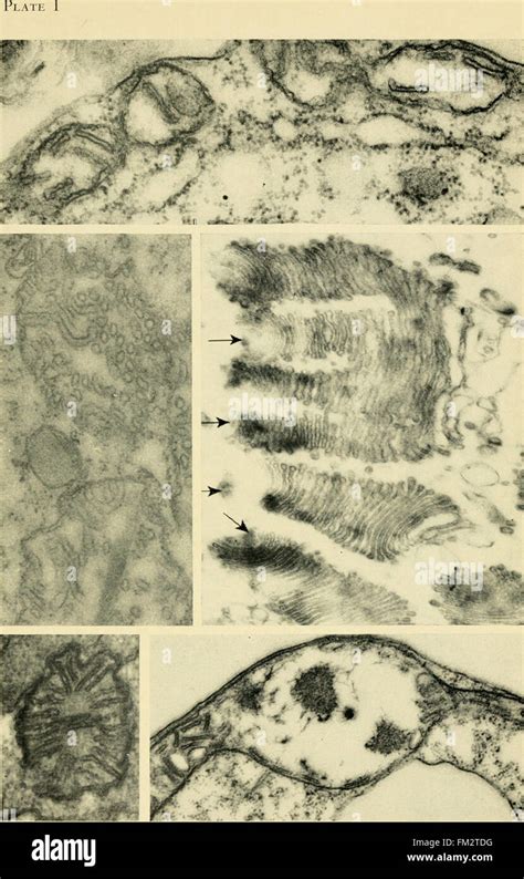 The 1963 Study On The Electron Microscopic Structure Of Protozoa