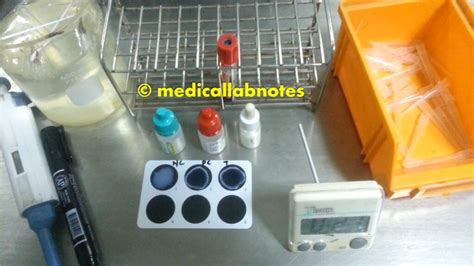 C Reactive Protein Crp Test Introduction Principle Testing