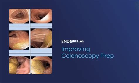 Endocollab™ Gi Endoscopy Education On Linkedin Improving Colonoscopy
