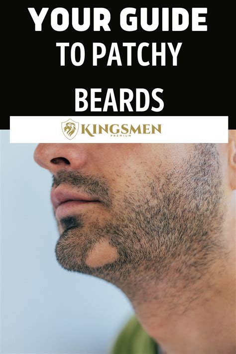 How To Get Rid Of Beard Rash Once And For All Artofit