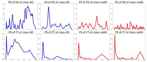 Alzheimer Disease Detection From Raman Spectroscopy Of The Cerebrospinal Fluid Via Topological