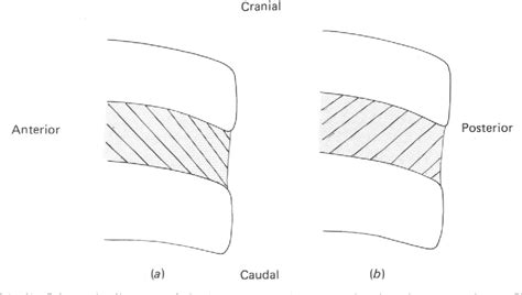 Figure 1 From Collagen Organisation In The Interspinous Ligament And