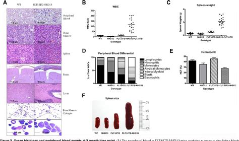 Figure 2 From Knock In Of A Flt3 Itd Mutation Cooperates With A Nup98 Hoxd13 Fusion To Generate
