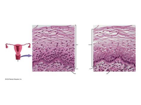 Stratified Squamous Epithelium Keratinized Vs Non Keratinized