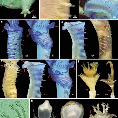 A Cirriform Pygidium Of Pygospio Elegans Stained With Methyl Green