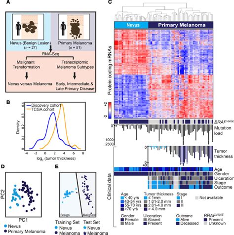 gene expression based classification of primary melanomas and benign