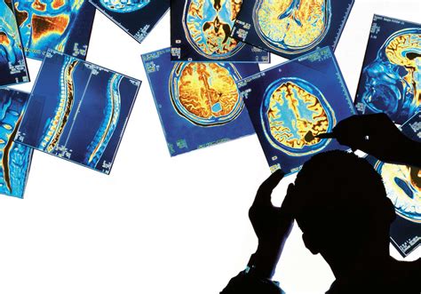 Le Cerveau Est Il Sexu Science Et Vie