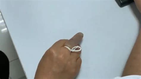 “教科书”式自救！大妈被毒蛇咬伤后一系列操作受医生赞扬我苏网