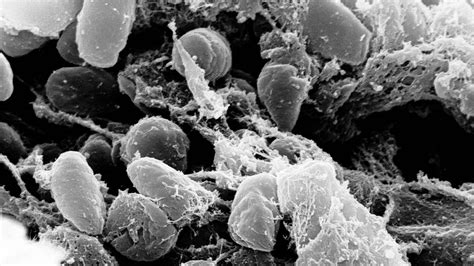 Researchers Discover Origin Of The Black Death Daily Telegraph Nz
