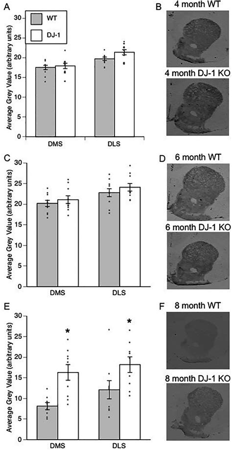 Tyrosine Hydroxylase Staining In Dorsal Striatum Data Shown Are