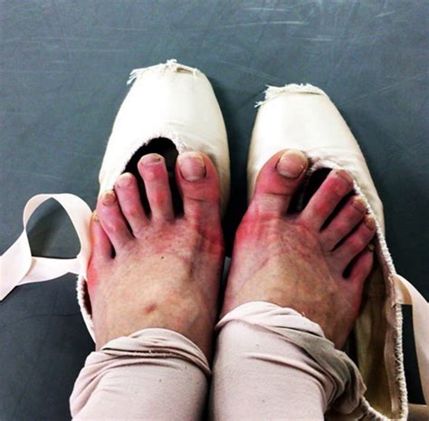 24 Struggles People Who Arent Dancers Wont Understand Ballet Dancer Feet Ballerina Feet
