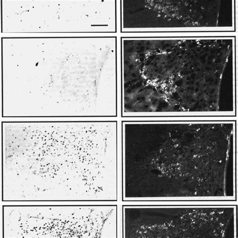 C Fos Immunohistochemical Activity In Magnocellular Neurons Of The Son