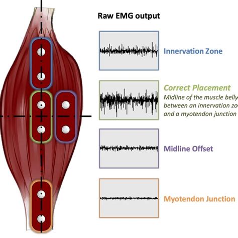 Top Level Architecture Of Continous Time Ct Charge Based Adc With Download Scientific Diagram